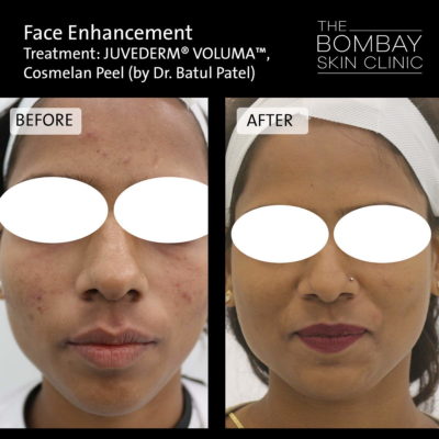 Skin Specialist in Mumbai | The Bombay Skin Clinic | Dr. Batul Patel