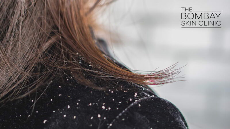 Benefits of Medi Facial Treatment - Facts, Results & Skin-care Tips | The Bombay Skin Clinic