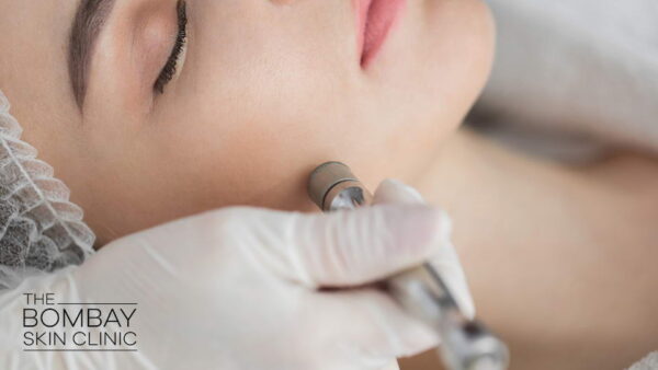 Benefits of Diamond Facial Treatment - Results & Skin-care Tips | The ...